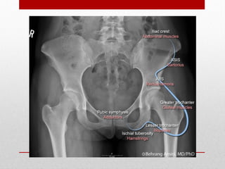 Paediatric Minor Trauma | PPT