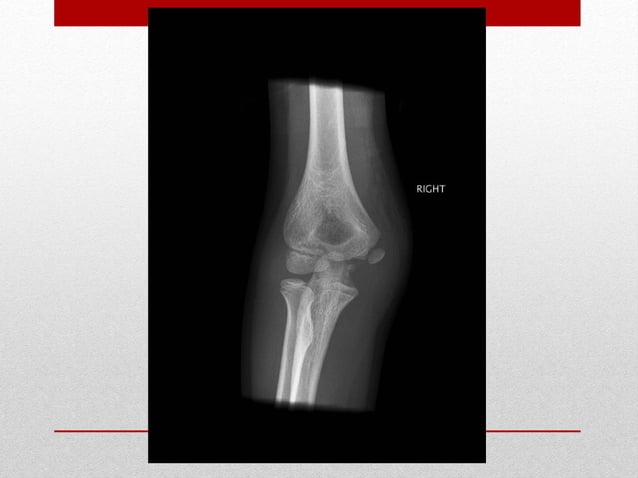 Paediatric Minor Trauma | PPT