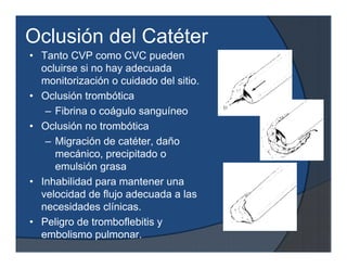 Terapia de infusion de las complicaciones a las soluciones | PDF