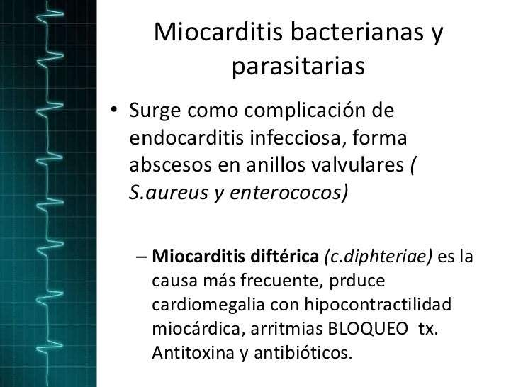 Miocarditis