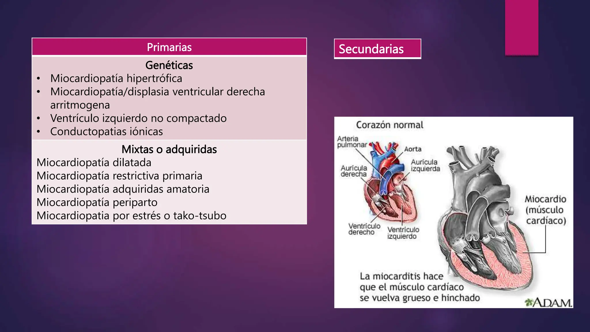 Miocarditis. Patologías Info.completapptx | PPTX | Heart and ...