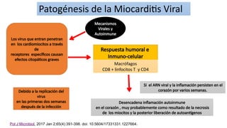Miocarditis Aguda 2024 medicina interna.pptx