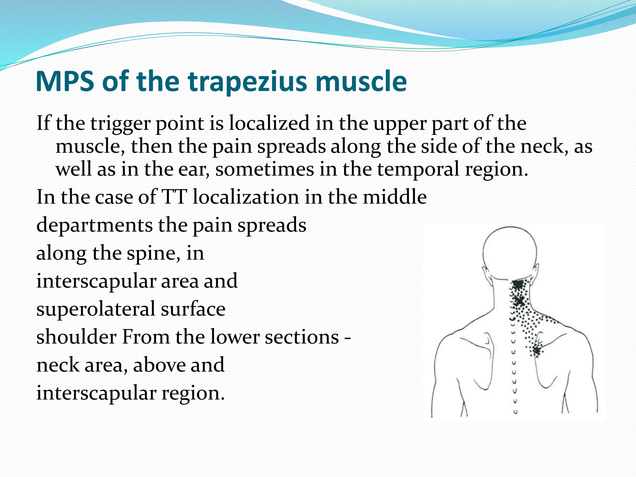 myofascial pain syndrome ENG pptttt.pptx