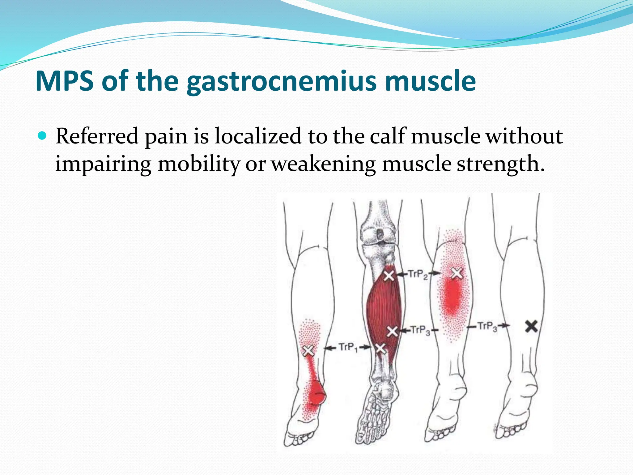 myofascial pain syndrome ENG pptttt.pptx