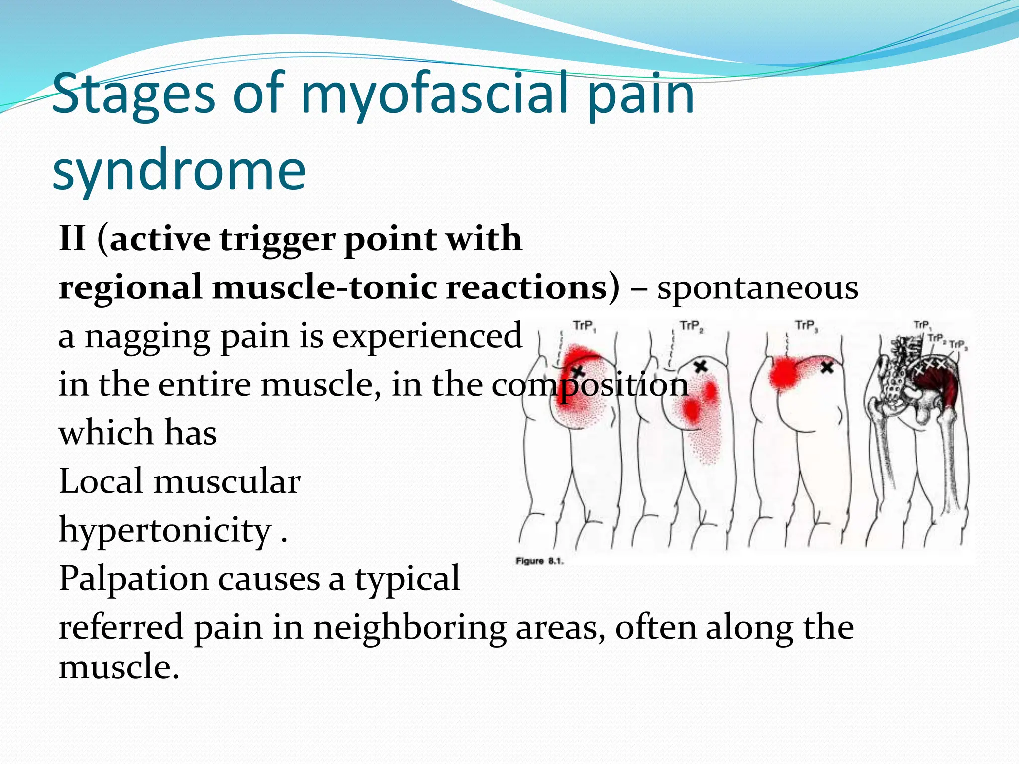 myofascial pain syndrome ENG pptttt.pptx