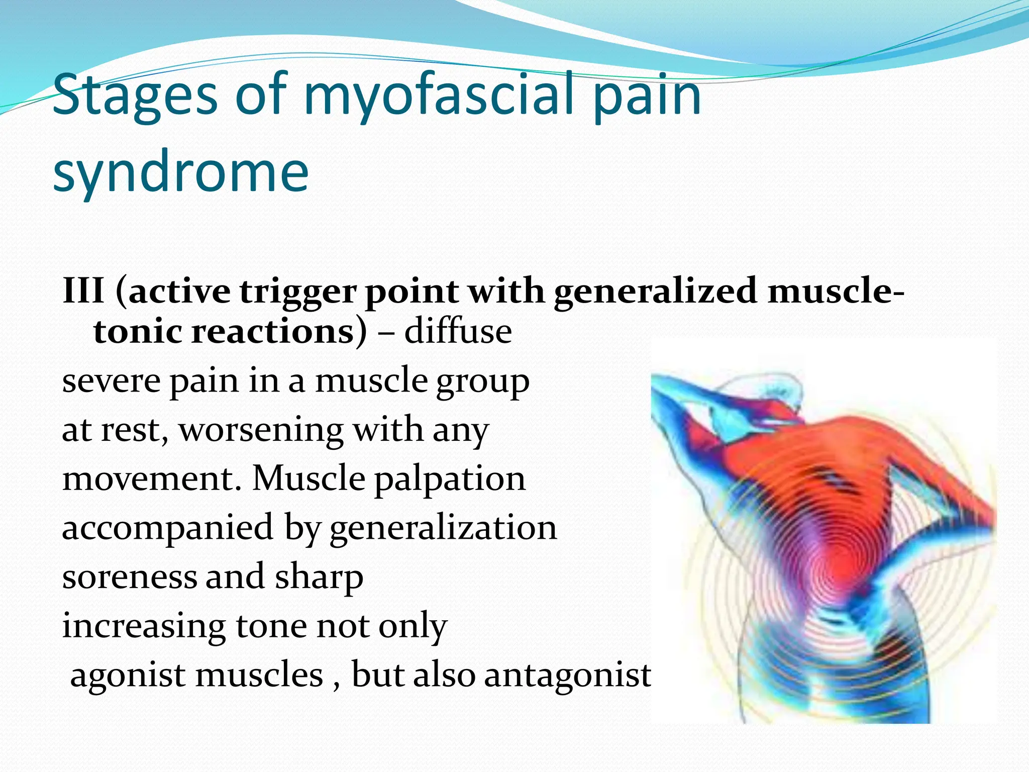myofascial pain syndrome ENG pptttt.pptx