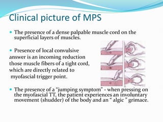 myofascial pain syndrome ENG pptttt.pptx