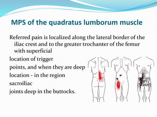 myofascial pain syndrome ENG pptttt.pptx