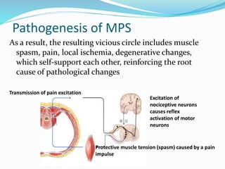 myofascial pain syndrome ENG pptttt.pptx