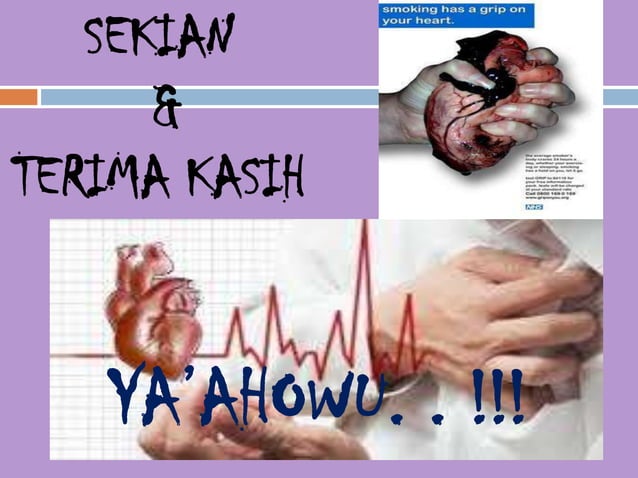 Miokard infark | PPTX