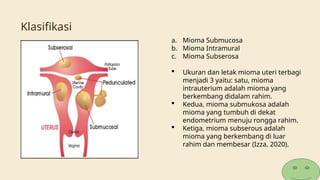 Miom-Uteri-Pengertian-Etiologi-dan-Penatalaksanaan sem 7.pptx