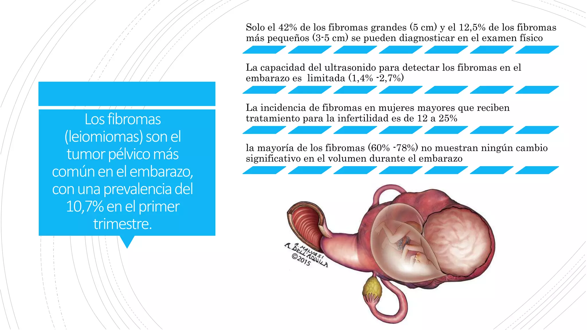 Miomas uterinos y el embarazo | PPT