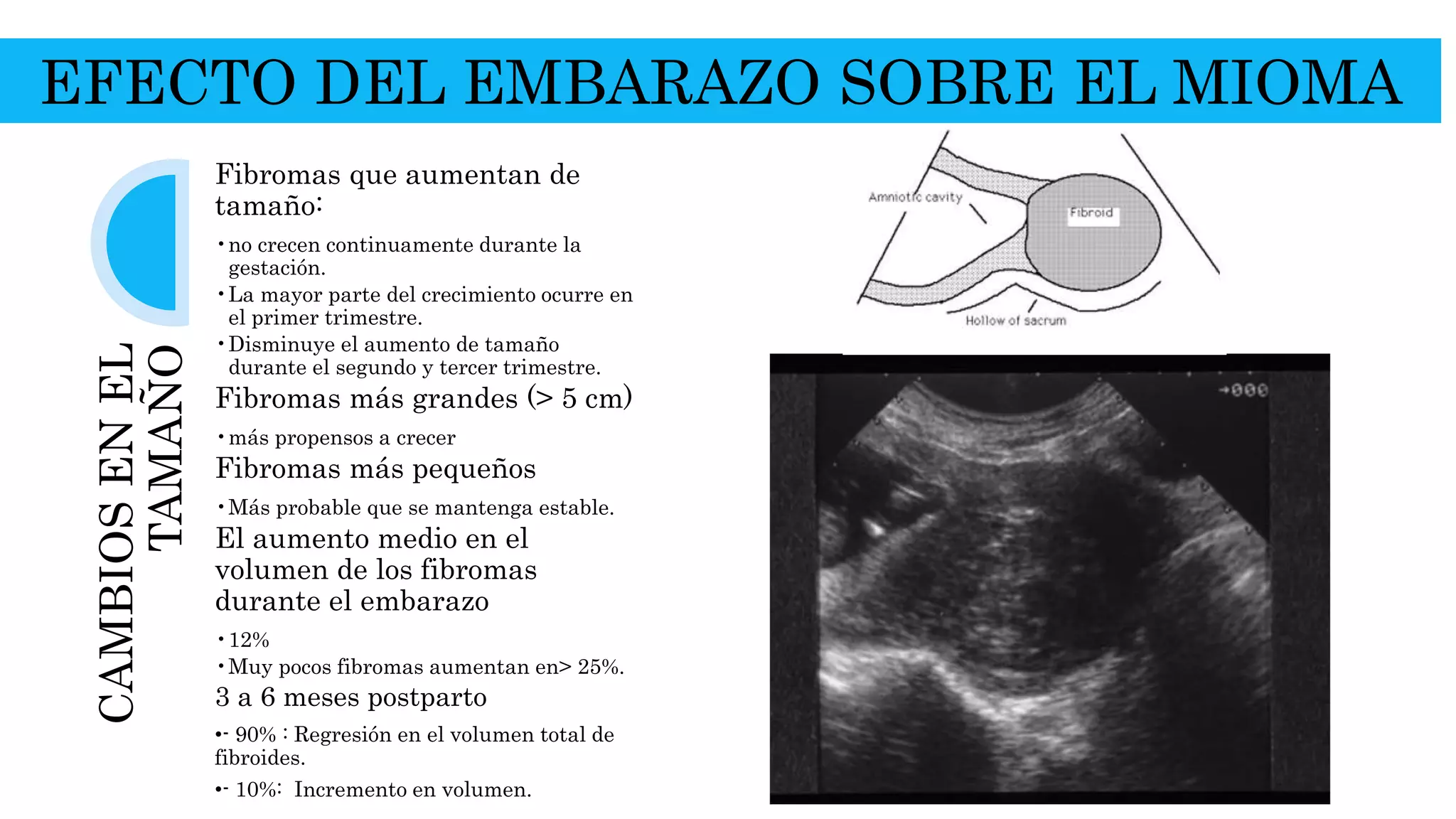 Miomas uterinos y el embarazo | PPT
