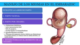 Miomas uterinos y el embarazo | PPTX