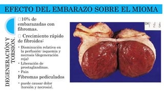 Miomas uterinos y el embarazo | PPTX