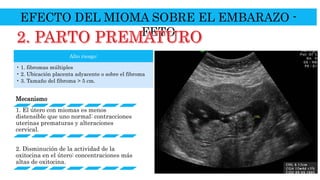 Miomas uterinos y el embarazo | PPTX