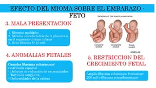 Miomas uterinos y el embarazo | PPTX