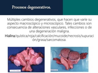 MIOMATOSIS UTERINA | PPTX