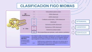 Miomatosis uterina | PDF