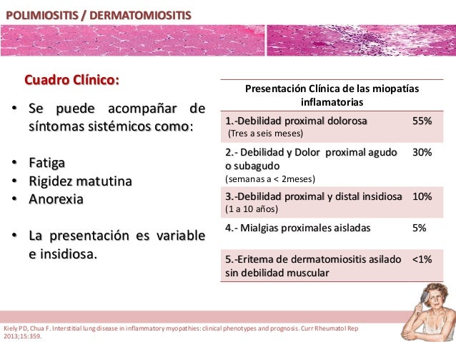 Polimiositis y Dermatomiositis