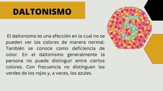 miopia y daltonismo Patología Visual y Ocular 03MOD | PPTX | Eye and Vision Conditions ...