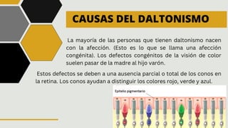 miopia y daltonismo Patología Visual y Ocular 03MOD | PPTX
