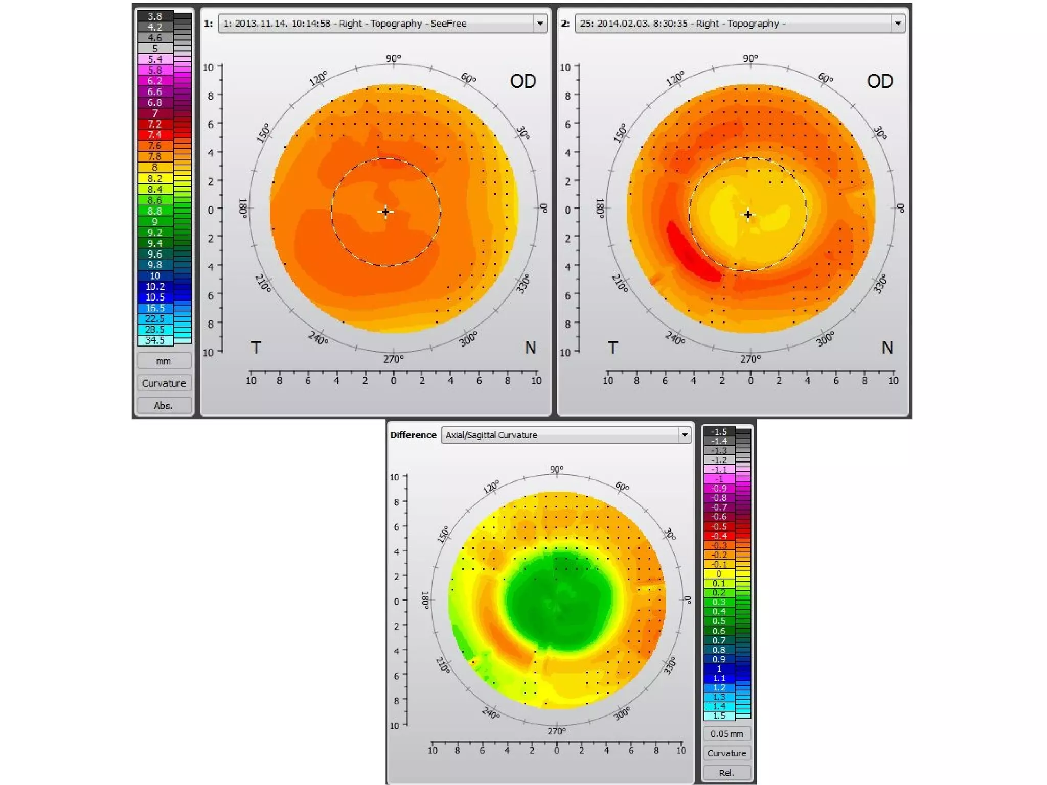 Miopijas kontrole | PPT