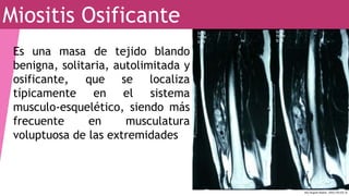 Miositis Osificante.pptx
