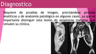 Miositis Osificante.pptx
