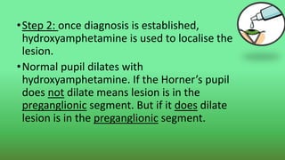 Miotics and mydriatics | PPTX