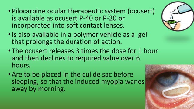 Miotics and mydriatics | PPTX | Eye and Vision Conditions | Diseases ...