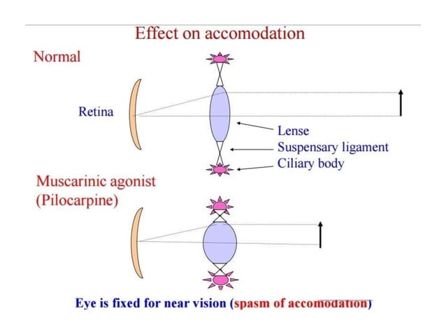 Miotics mydriatics cycloplegics | PPTX | Eye and Vision Conditions ...