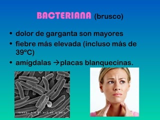 AMIGDALITIS | PPT