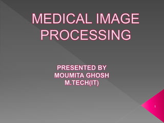 MEDICAL IMAGE PROCESSING | PPTX