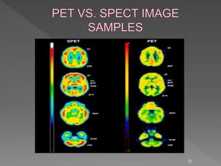 MEDICAL IMAGE PROCESSING | PPTX