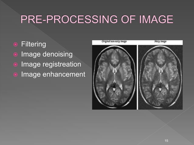 MEDICAL IMAGE PROCESSING | PPTX | Photo Editing Software | Computer Software and Applications