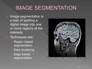 MEDICAL IMAGE PROCESSING | PPTX