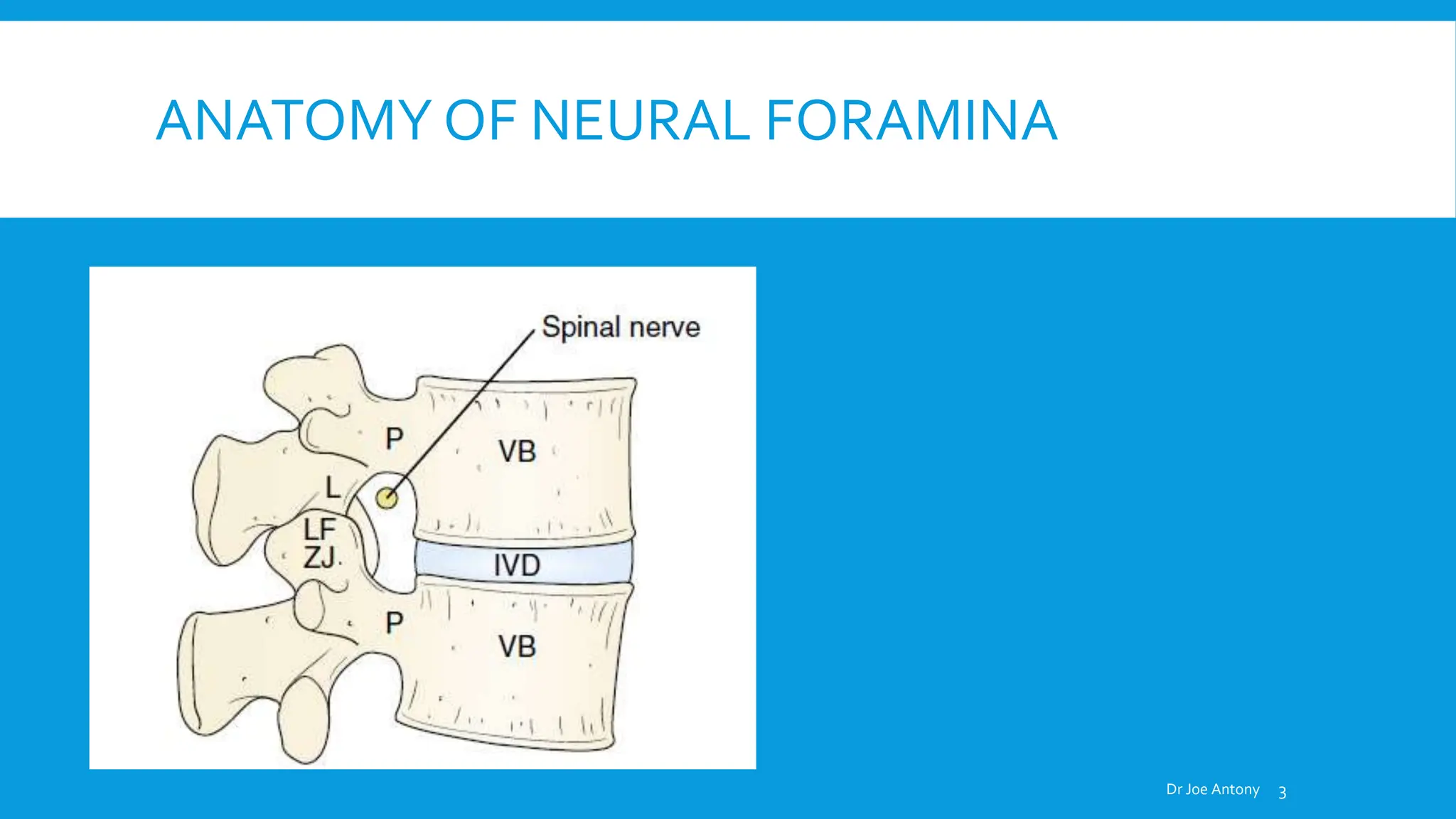Minimally invasive pain and spine interventions for low back pain | PPTX