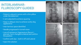Minimally invasive pain and spine interventions for low back pain | PPTX