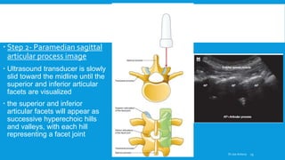 Minimally invasive pain and spine interventions for low back pain | PPTX