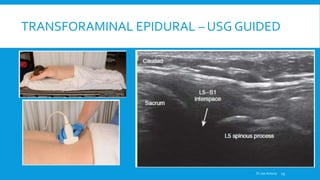 Minimally invasive pain and spine interventions for low back pain | PPTX