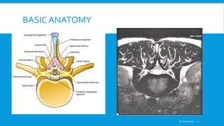 Minimally invasive pain and spine interventions for low back pain | PPTX