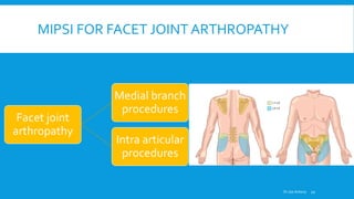 Minimally invasive pain and spine interventions for low back pain | PPTX