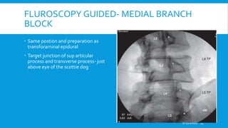 Minimally invasive pain and spine interventions for low back pain | PPTX
