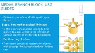 Minimally invasive pain and spine interventions for low back pain | PPTX