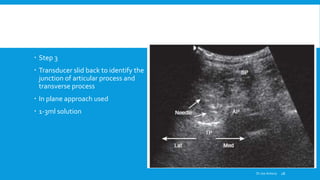 Minimally invasive pain and spine interventions for low back pain | PPTX