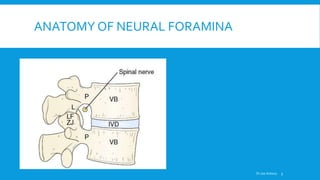 Minimally invasive pain and spine interventions for low back pain | PPTX