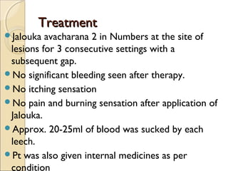 Miracle leech By Dr Preetam | PPT