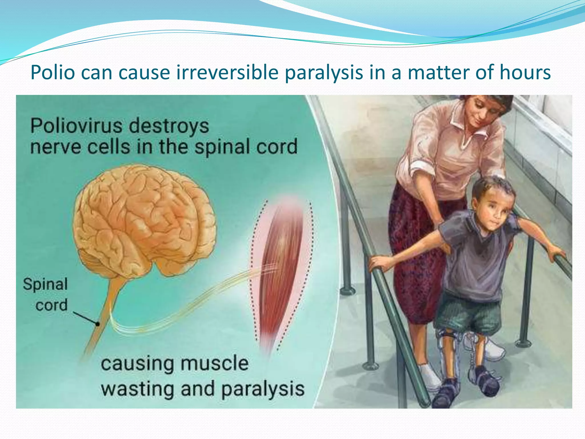 Polio vaccines - types and differences | PPTX