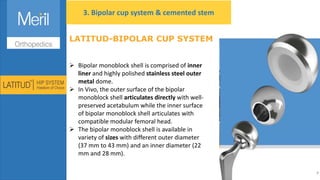 Mirel Orthopedic devices.pptx | Bone and Joint Conditions | Diseases ...